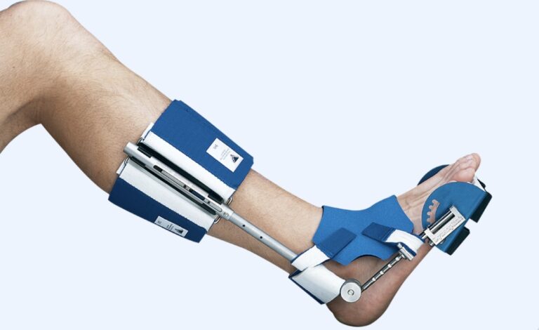 Joint Contracture Treatment, Research & Support | JC.org