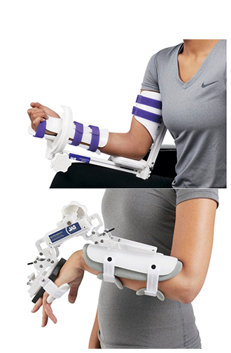 Joint Contracture
