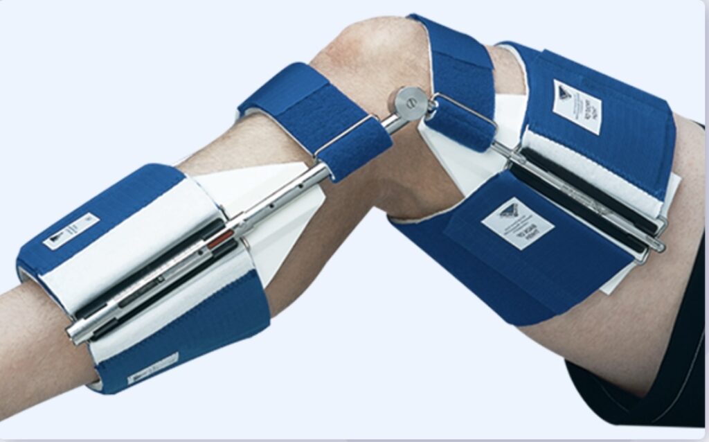 Joint Contracture Treatment, Research & Support | JC.org